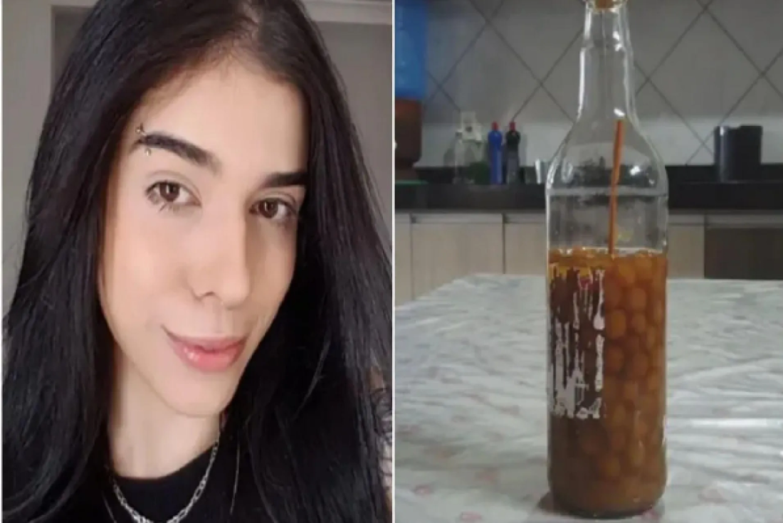Jovem Que Cheirou Pimenta Volta A Ser Internada Na Uti Devido A Queda